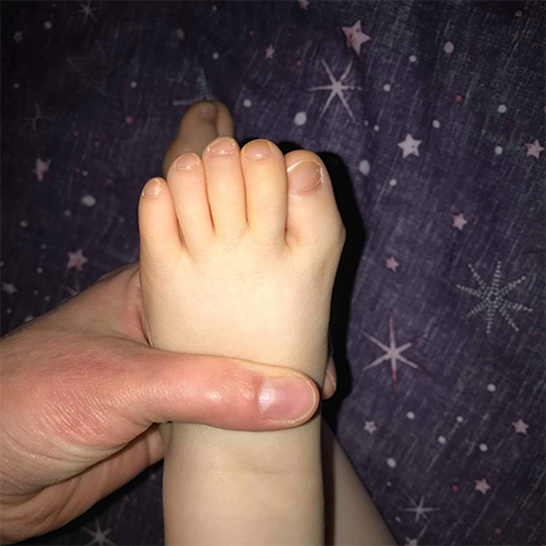 Diagnosing FOP - FOP Friends